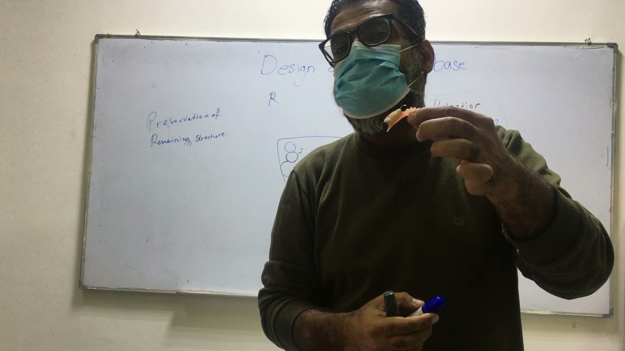 Designing of acrylic RPD (Mand Class III, Mod. 1) - YouTube