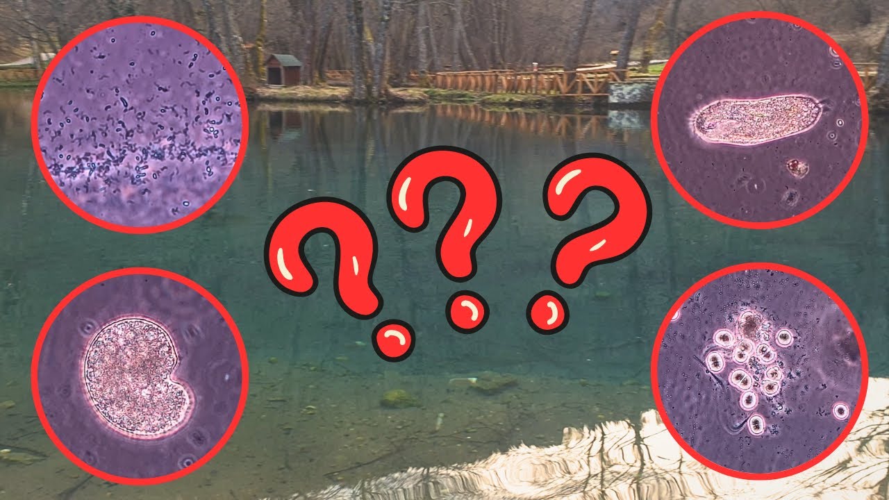 10 Microscopic Organisms I Found in a Drop of Pond Water - YouTube