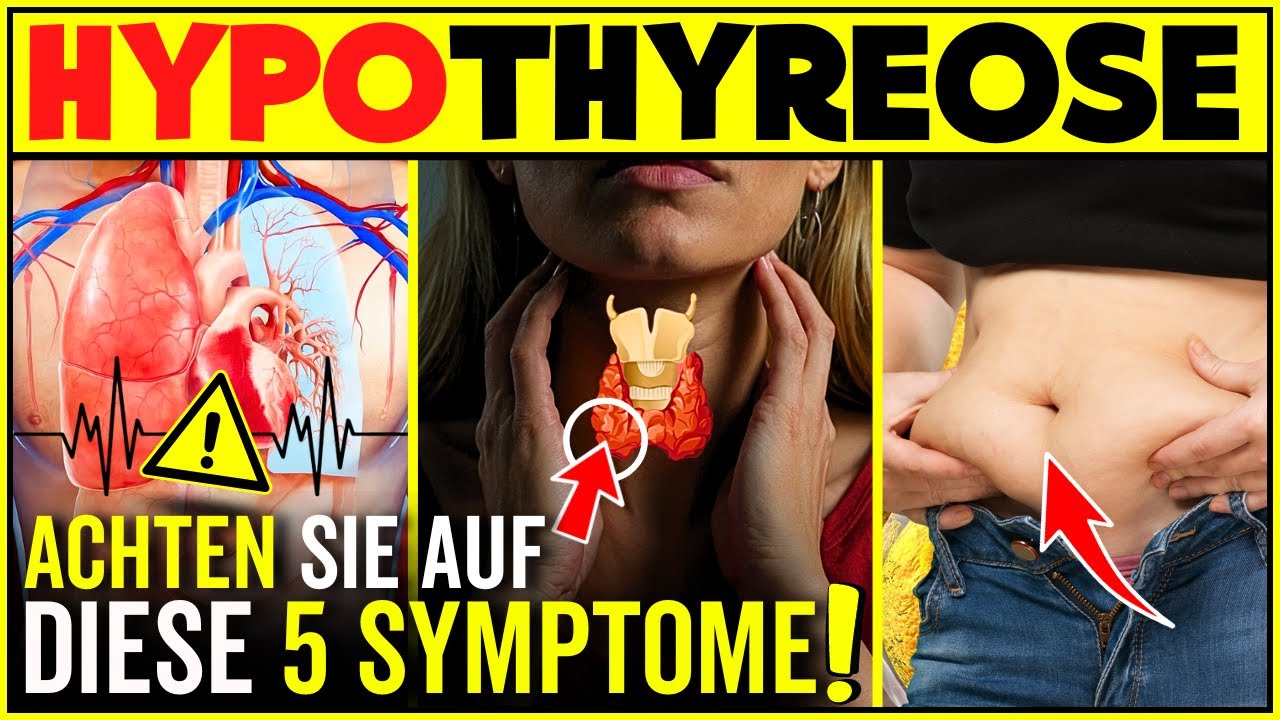 5 Anzeichen Und Symptome Einer Hypothyreose | Schilddrüsenprobleme: Wie ...