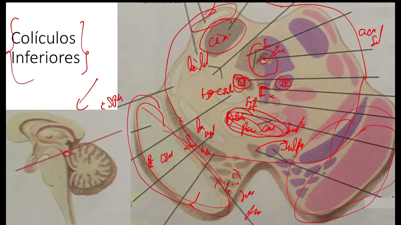 Colículos Inferiores y Nucleo del IV. Corte Transversal Mesencefalo ...