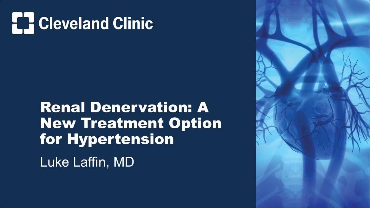 Renal Denervation: A New Treatment Option for Hypertension - YouTube