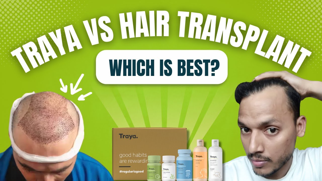 Traya vs Hair Transplant | Traya Treatment लेना चाहिए या Hair ...
