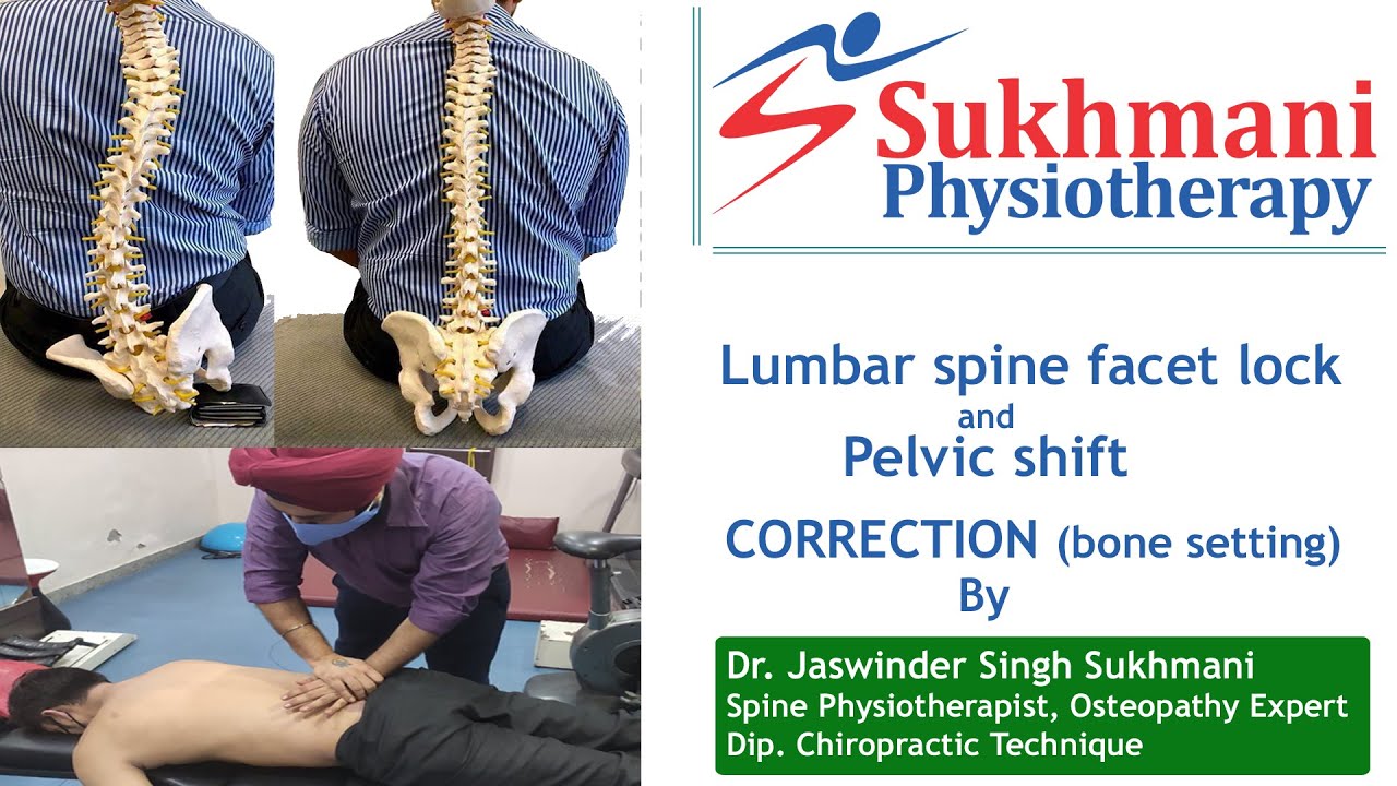 Lumbar spine facet lock and pelvic shift correction (bone setting ...