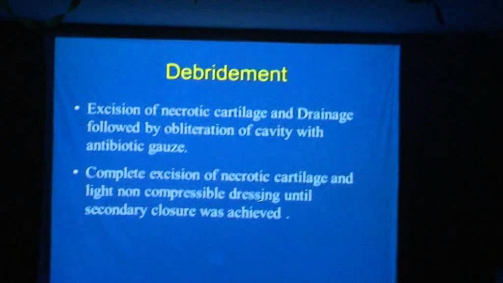 Reconstruction of burned Ear - YouTube