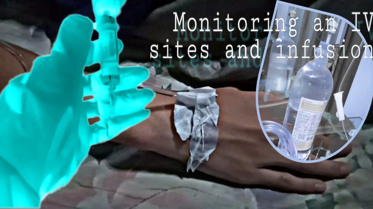 Monitoring an IV sites and Infusion•|Return Demonstrate - YouTube