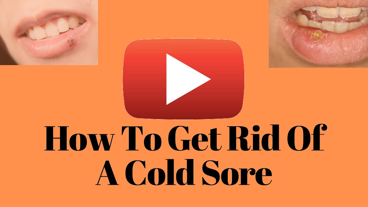 How To Get Rid Of A Cold Sore - YouTube