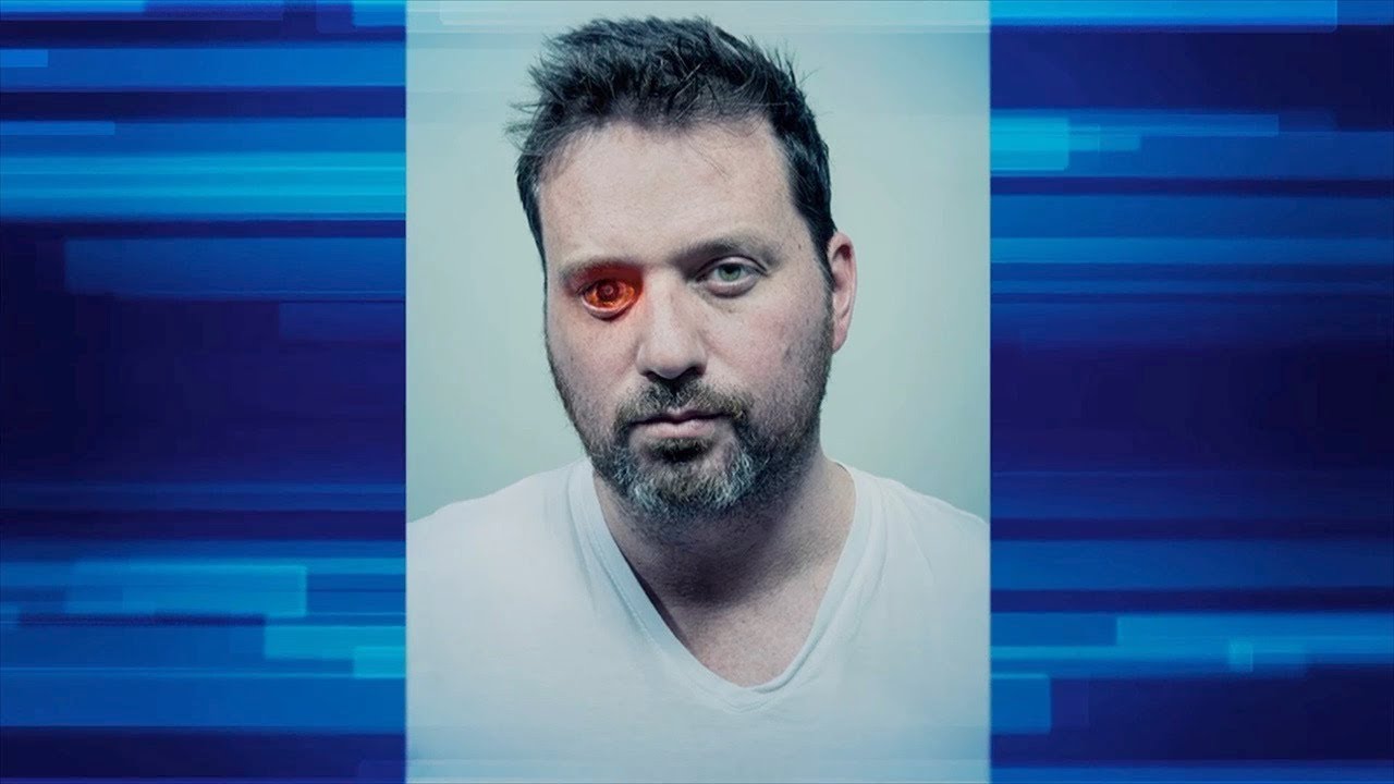 Man Places a Camera in His Eye Socket - YouTube