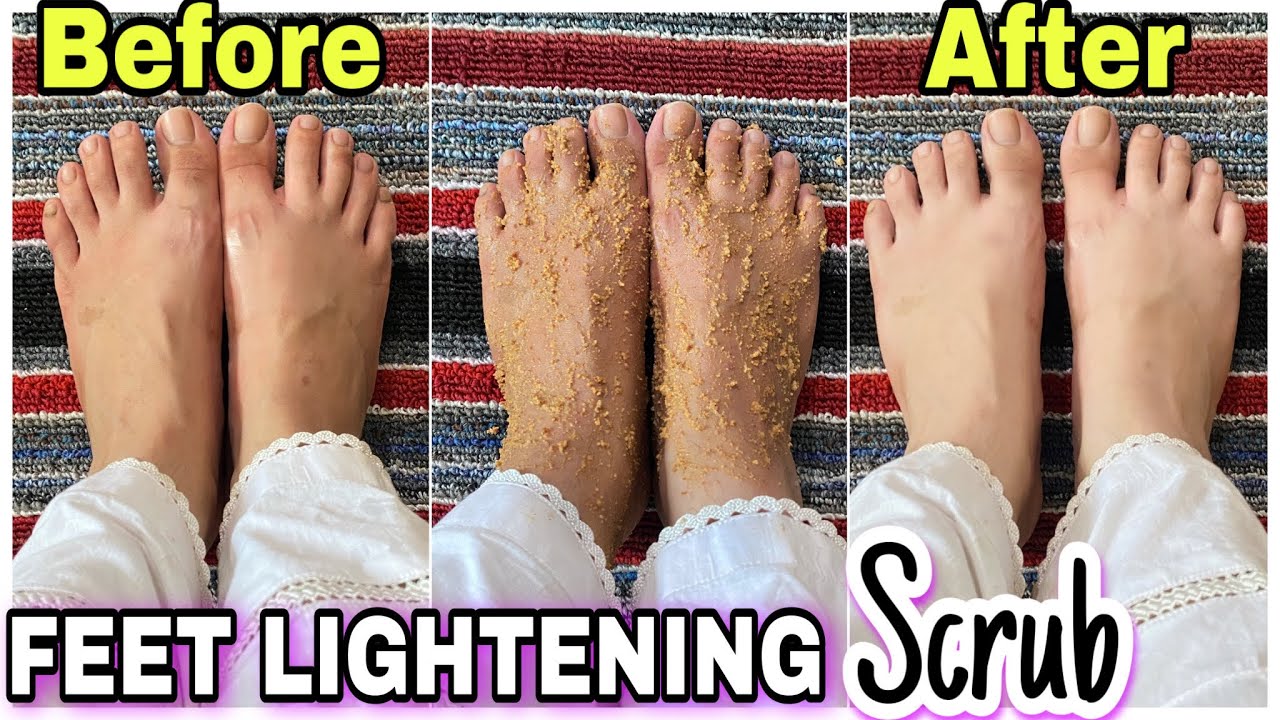DIY Feet Whitening Scrub To Remove Pigmentation, Sun Tan And Uneven ...