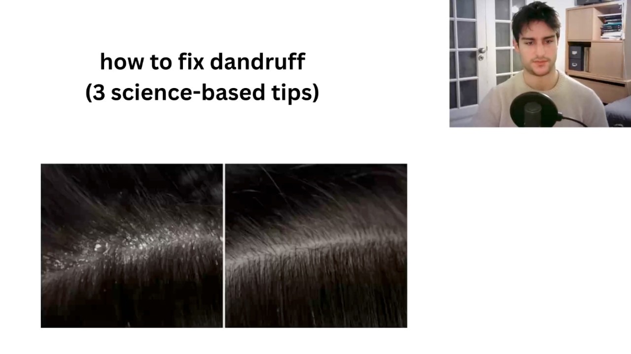 how to fix dandruff (3 science-based tips) - YouTube