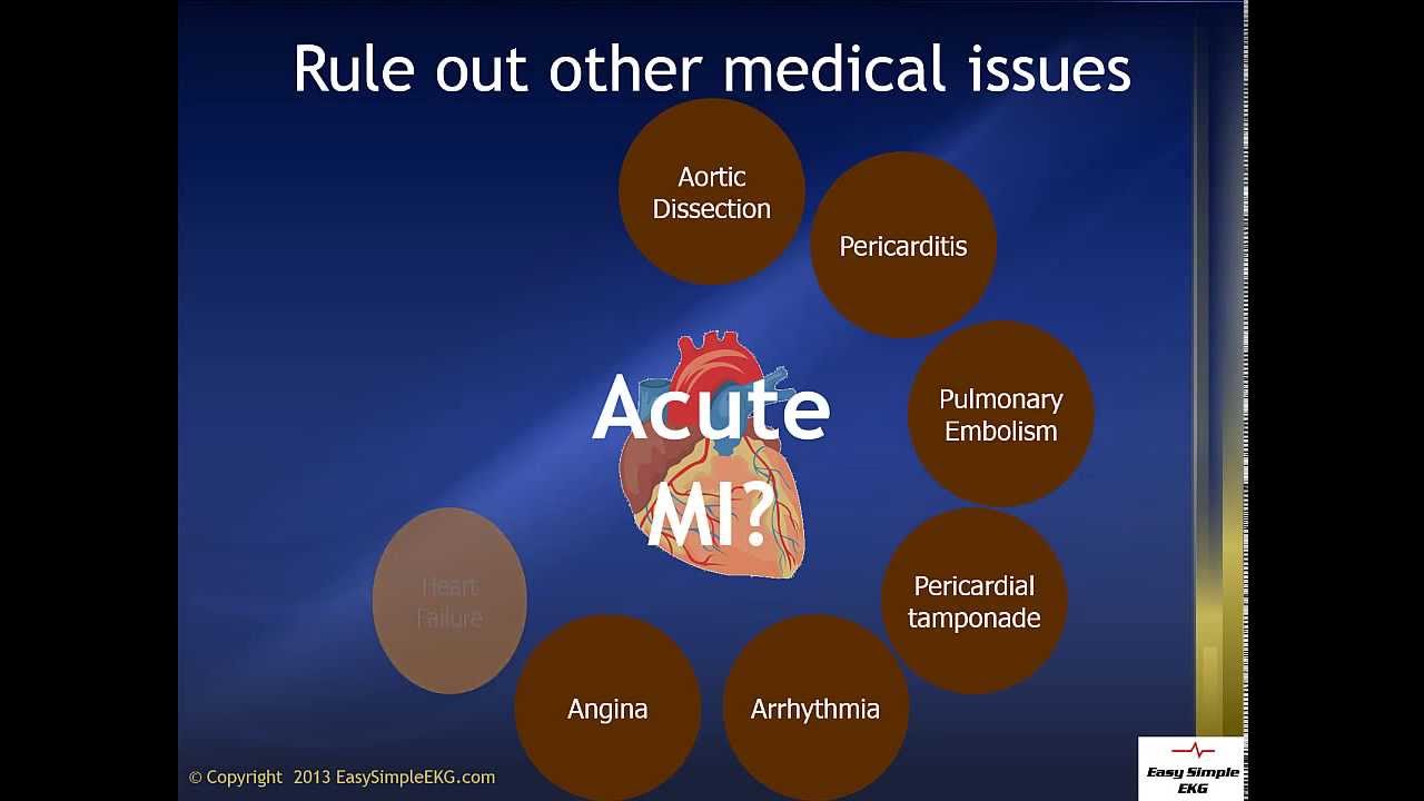 Diseases that Mimic Acute Myocardial Infarction (AMI) - YouTube