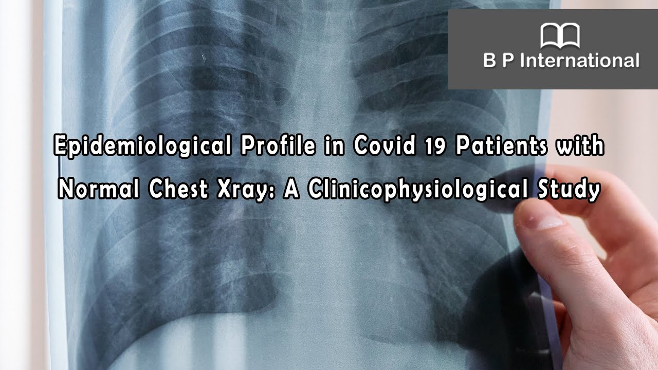 Epidemiological Profile in Covid 19 Patients with Normal Chest Xray: A ...