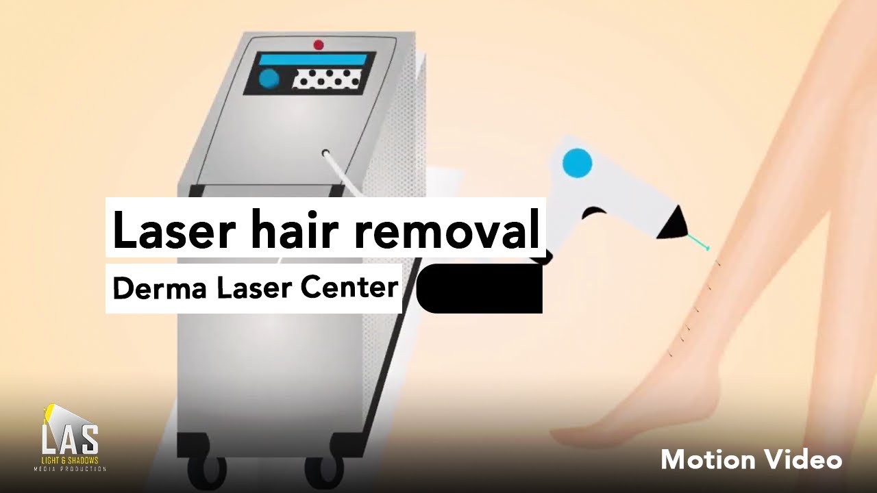 Motion Video | Derma Laser Center - Laser hair removal - YouTube
