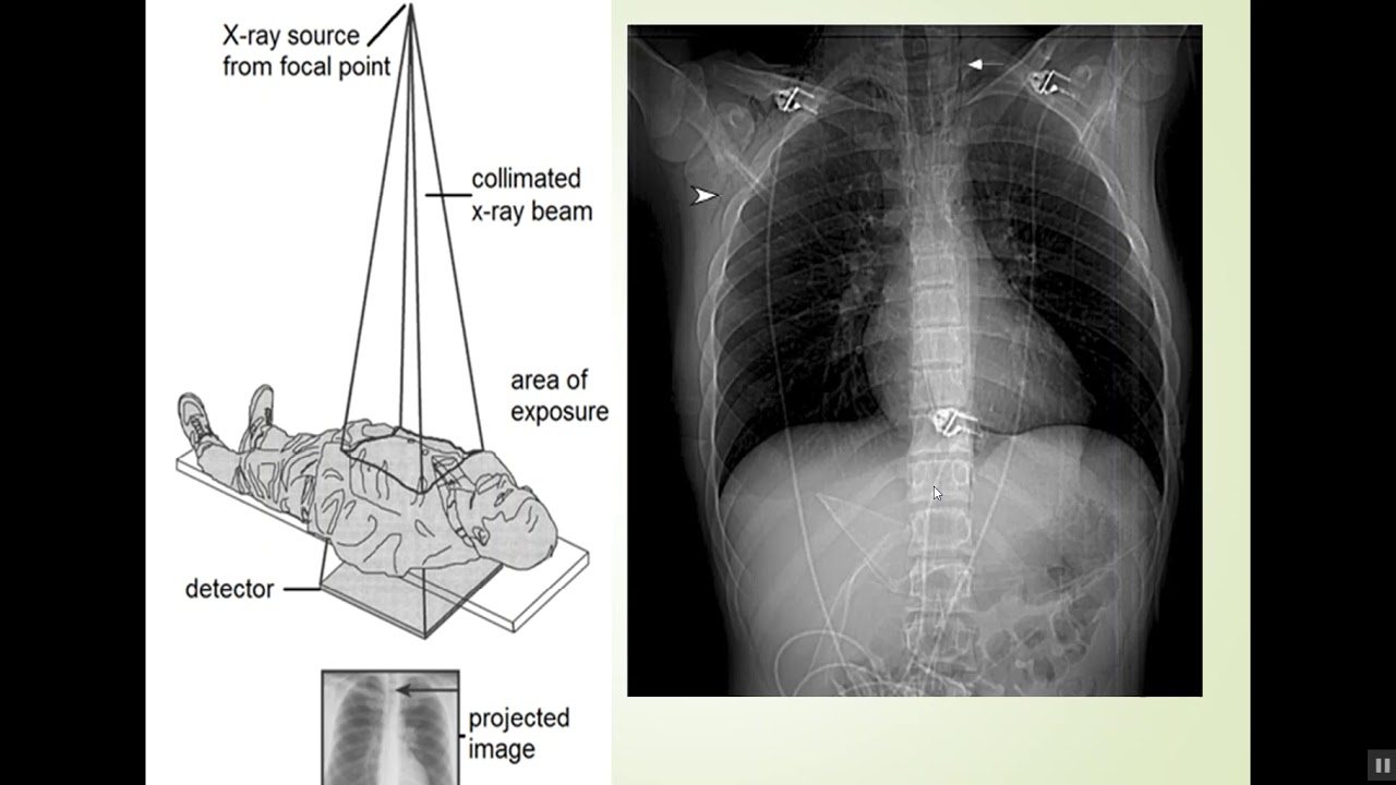 CT Physics in English Part 1 - YouTube