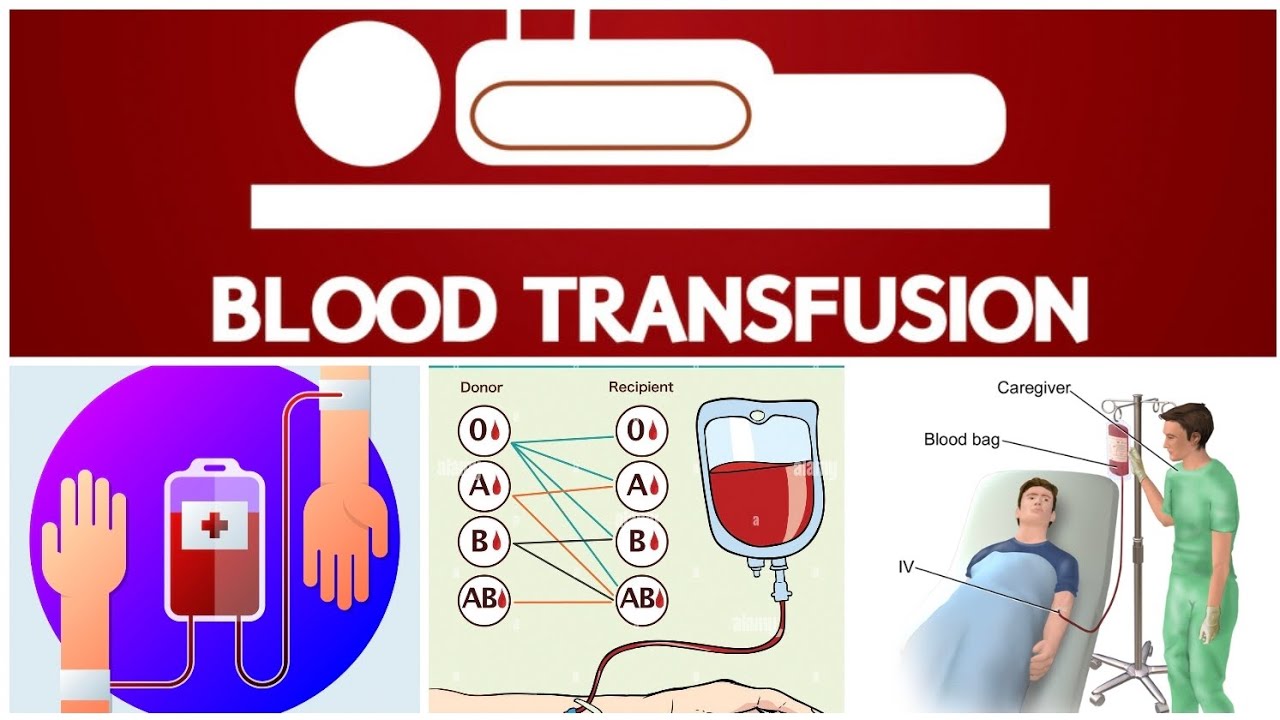 Blood Transfusion 4(last) | UQs + Massive Blood Transfusion ...