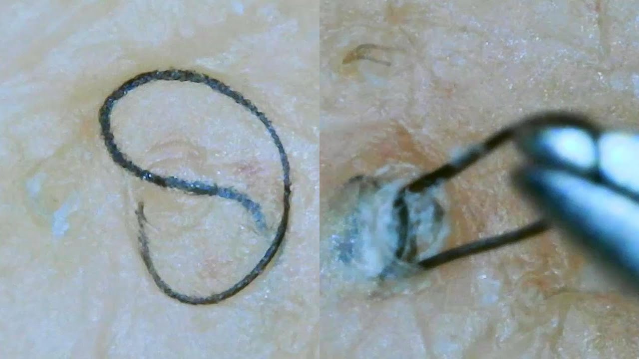 Plucking hairs ZOOM #65 - YouTube