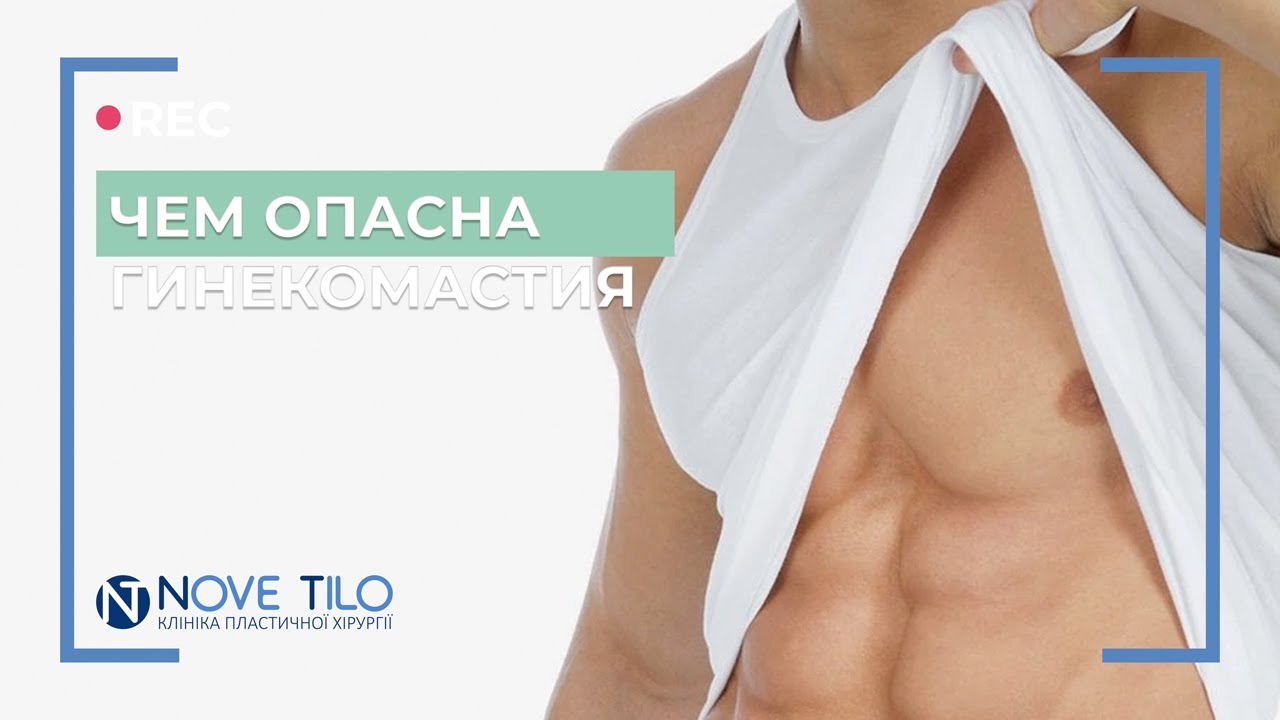 Чем опасна гинекомастия Youtube