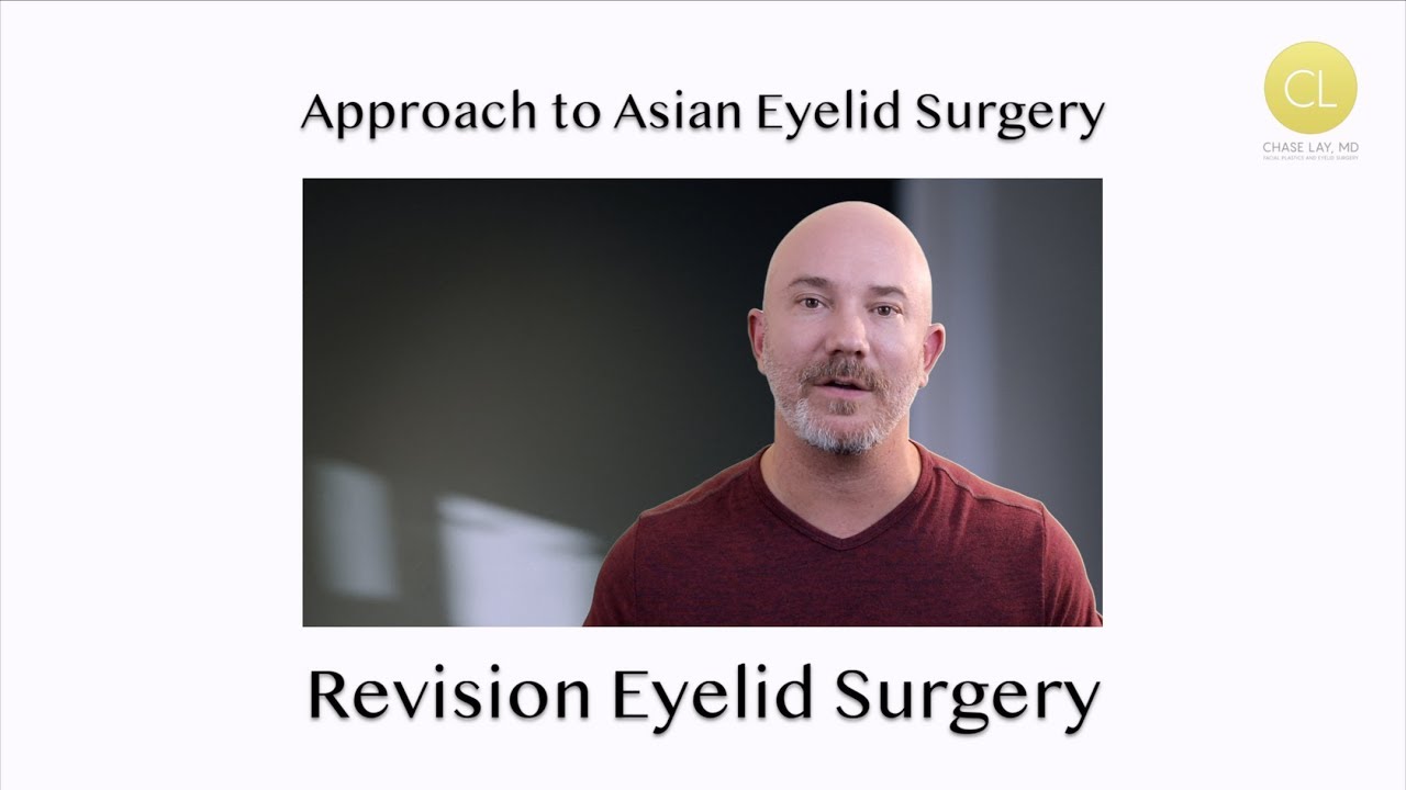 Approach to Asian Eyelid Surgery: Revision Eyelid Surgery with Chase ...
