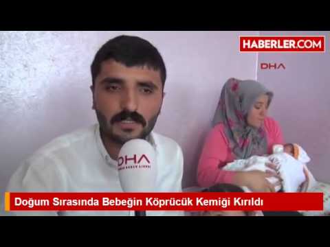 Doğum Sırasında Bebeğin Köprücük Kemiği Kırıldı