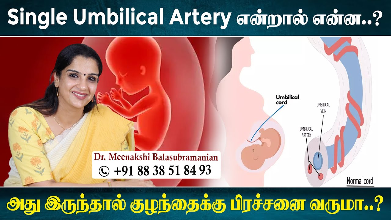 Single umbilical artery in Pregnancy and its significance..! - KRIA ...