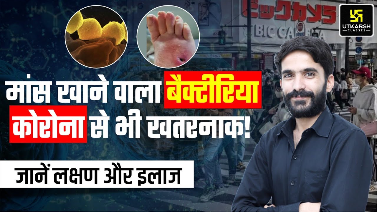 Japan Flesh Eating Bacteria🦠| Symptoms & Treatment | STSS Japan ...