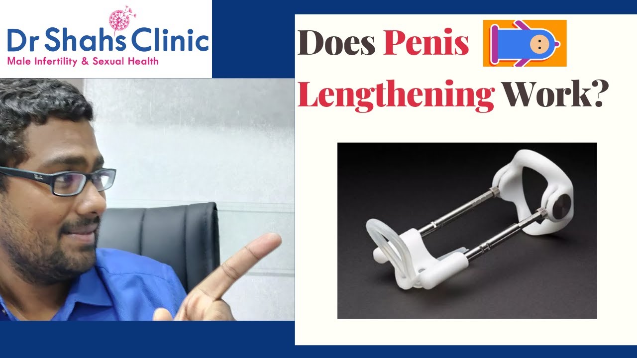 Does penis lengthening work? Dr Shahs Clinic has the answer - YouTube