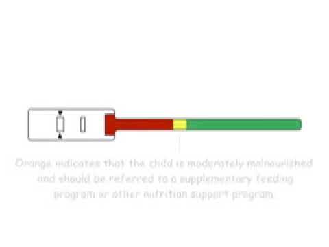 How to measure mid upper arm circumference (MUAC)- NNRRTC KSCH - YouTube