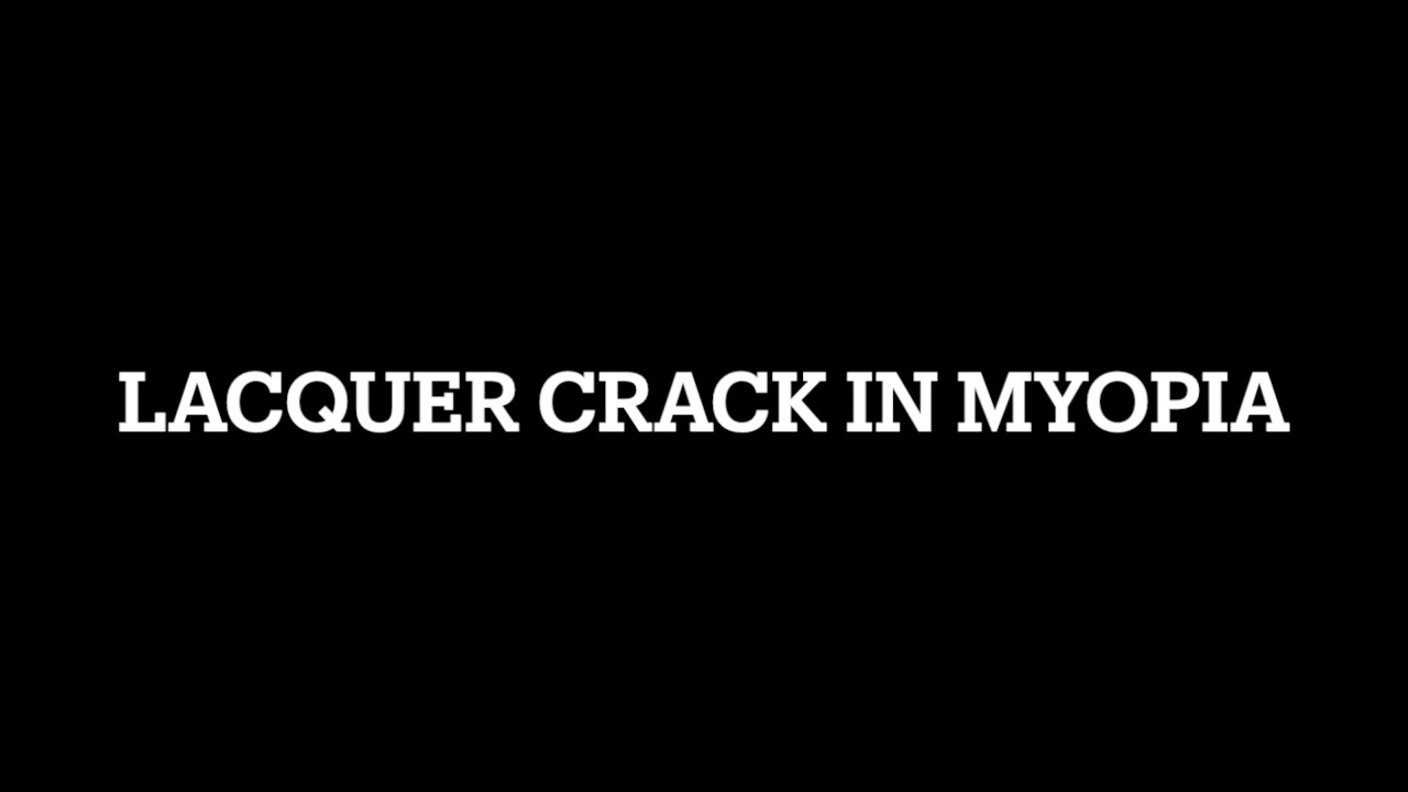 Retina tip 6 - lacquer crack in myopia - YouTube
