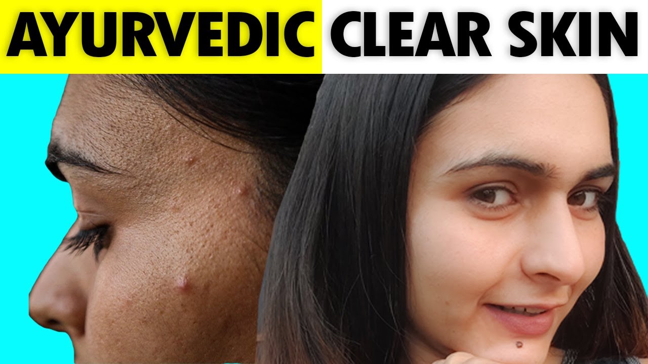 Ayurvedic Formula For Crystal Clear Skin || Acne, Pimple, Dark Spots ...