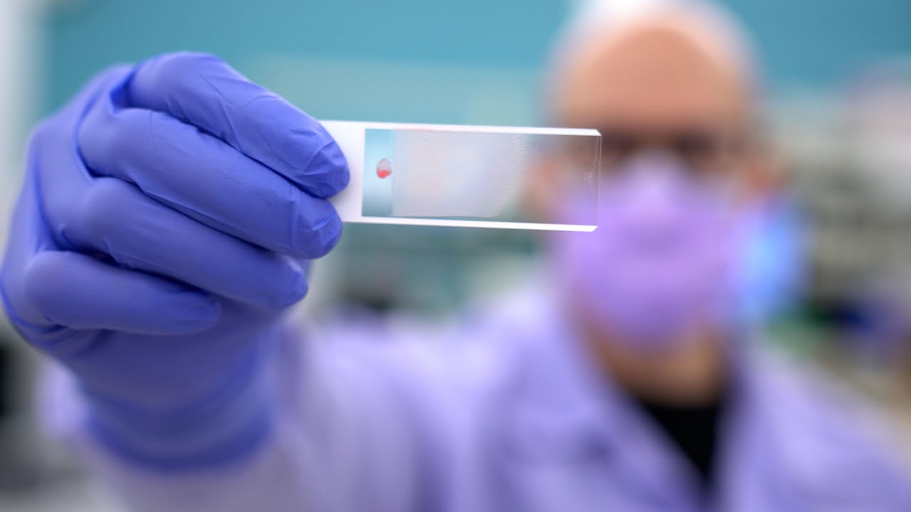 Mike's Story: Making an Impact Behind the Scenes in the Pathology Lab ...