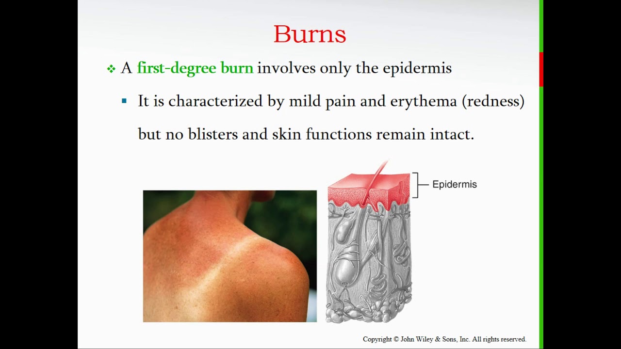 Skin Homeostasis Video lesson 5 - YouTube
