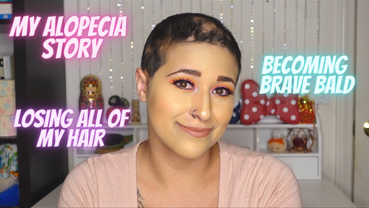My Alopecia Story. How I Lost ALL Of My Hair - YouTube