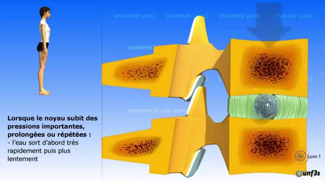 Le disque intervertébral - YouTube