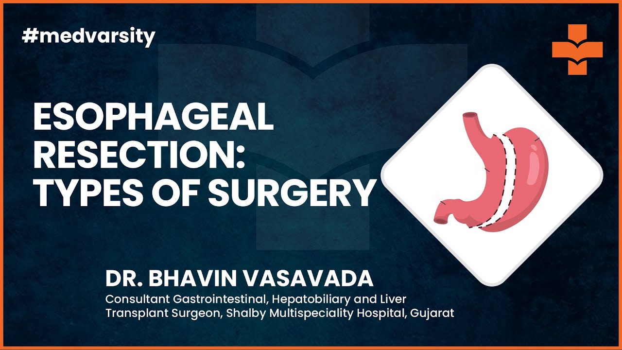 Esophageal Resection & Types of Surgery | @MedvarsityTechnologiesPvtLtd ...