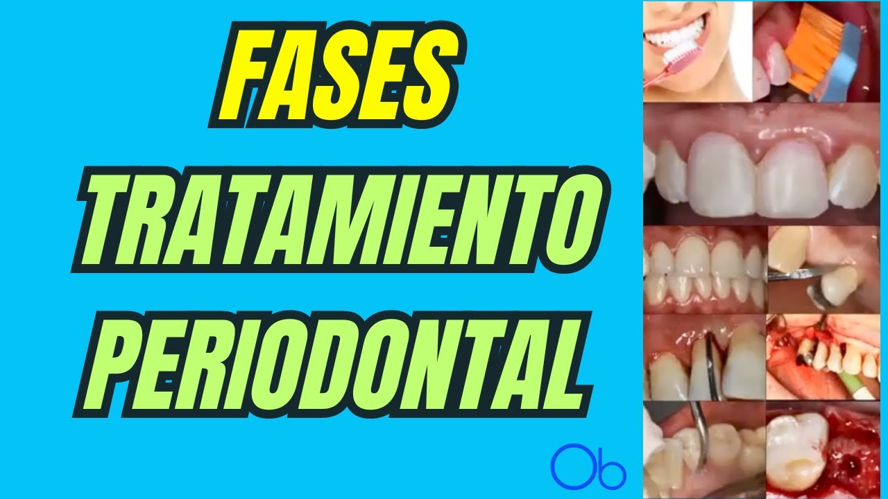 Fases del Tratamiento Periodontal - YouTube