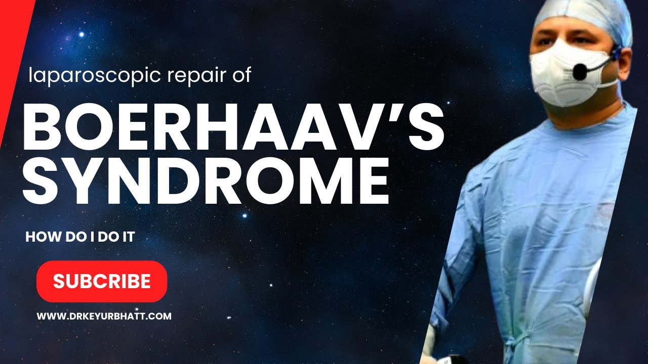 Boerhaav's syndrome | Lap repair of perforation | Esophageal ...