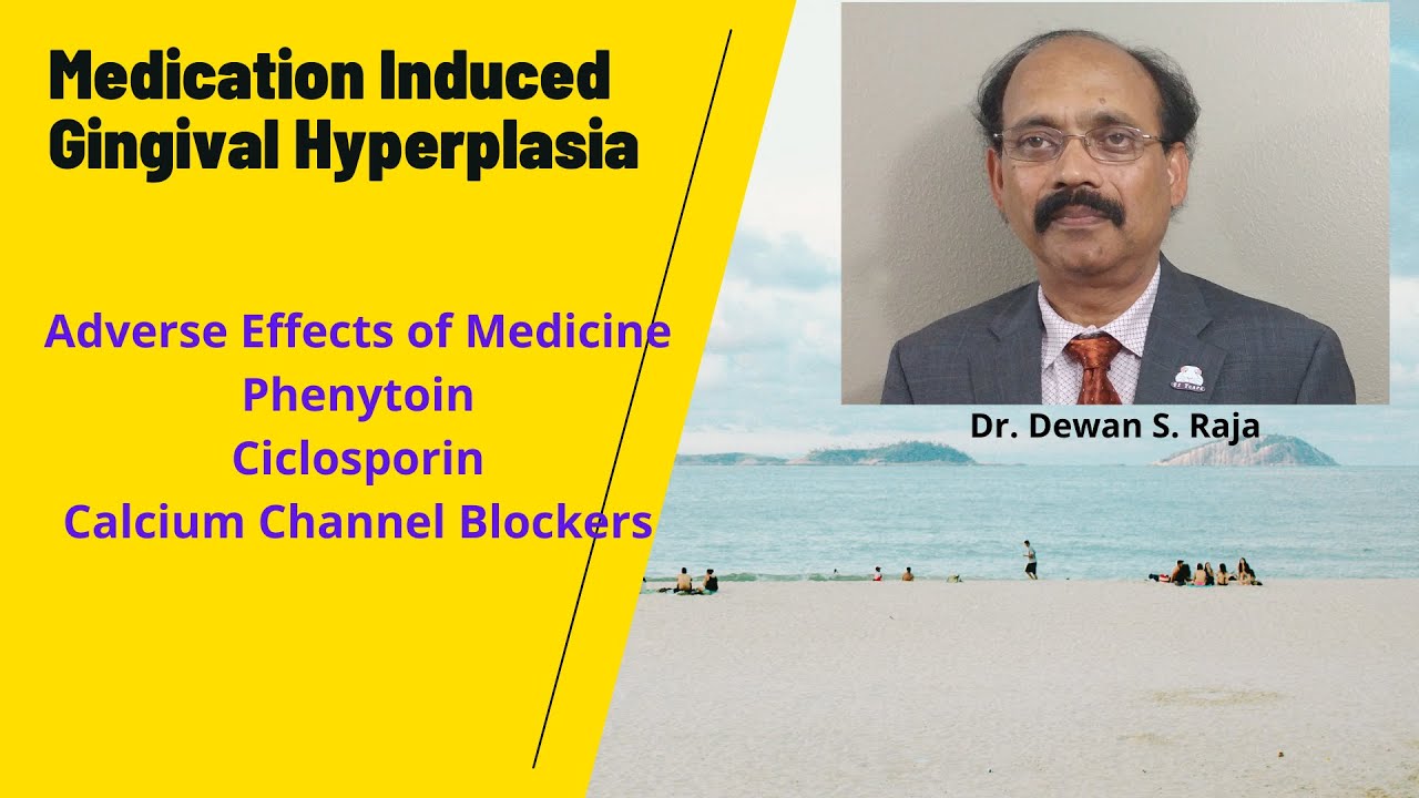 Medication Induced Gingival Hyperplasia - YouTube