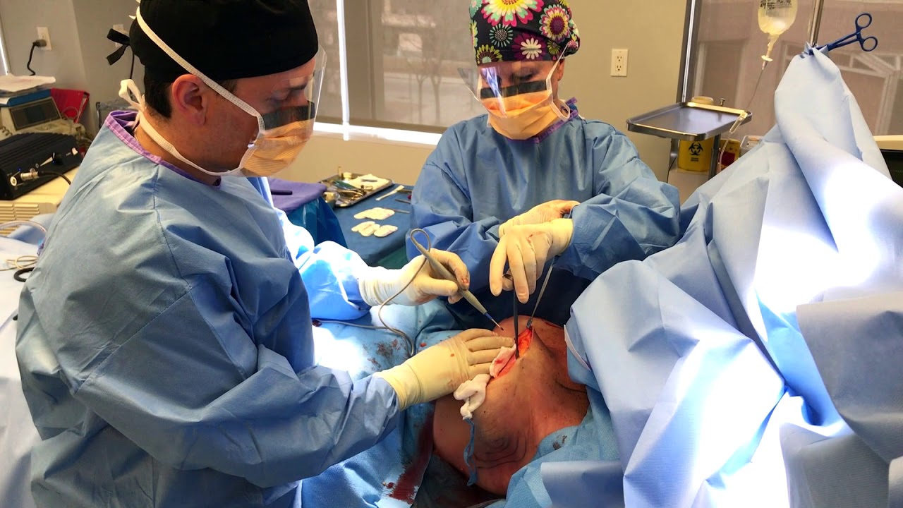 Mastopexie (redrapage) verticale par Dr. Guberman - YouTube