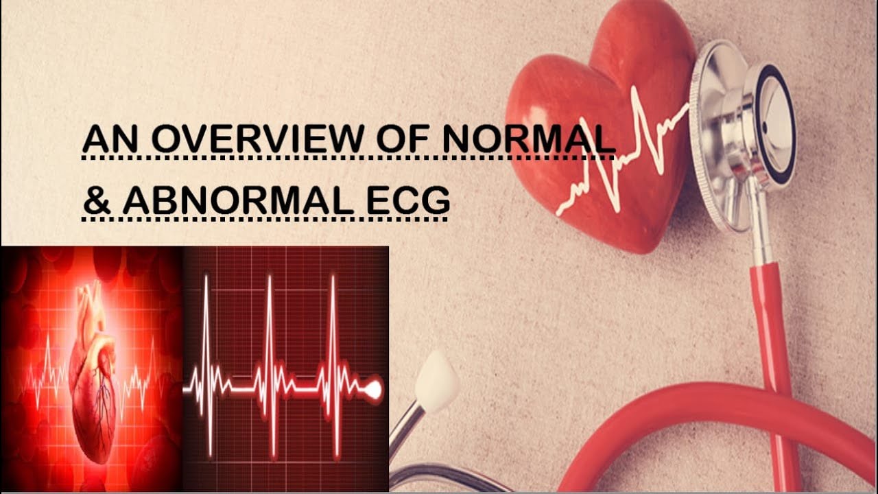 An overview of normal ECG & abnormal ECG - YouTube