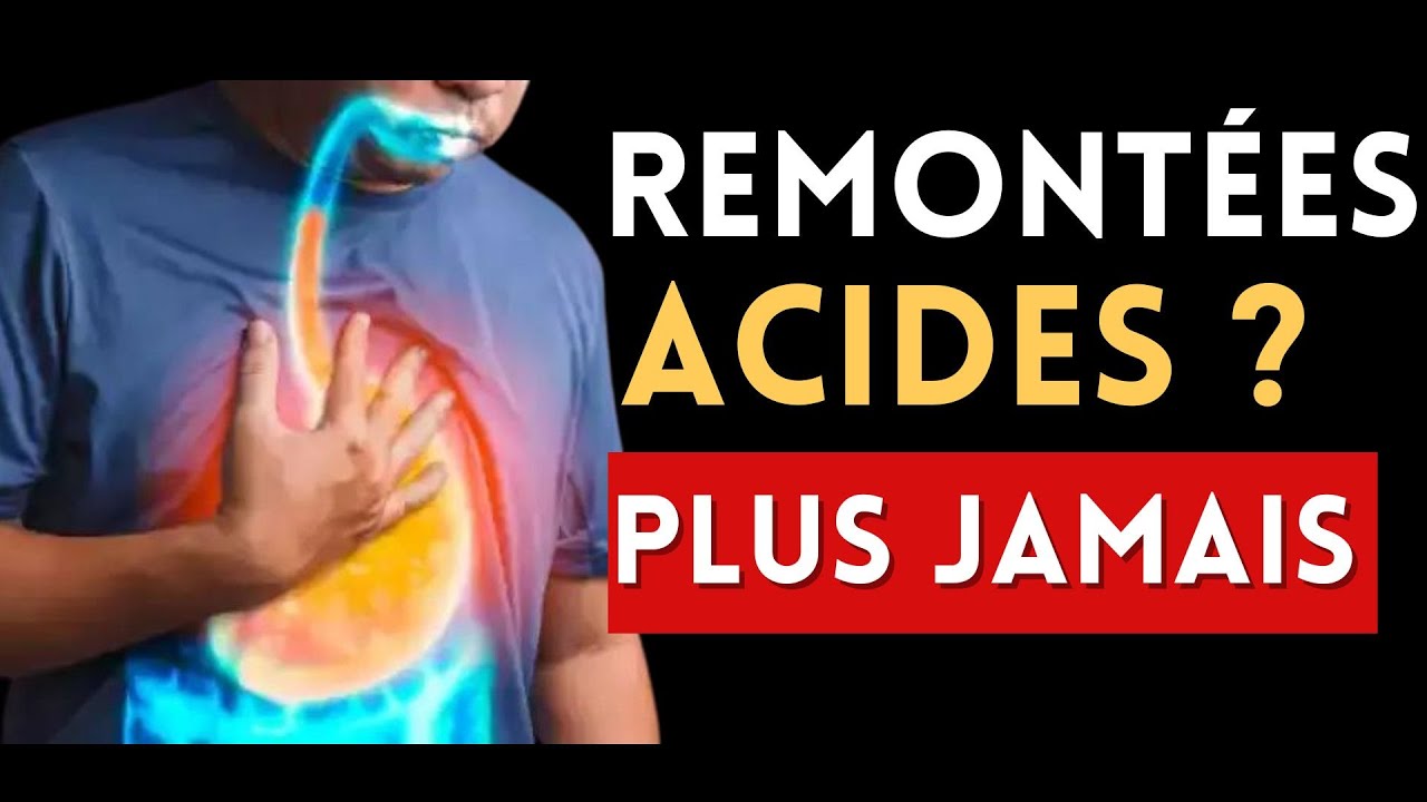 5 vitamines pour arrêter les LES REMONTÉES ACIDES naturellement - YouTube
