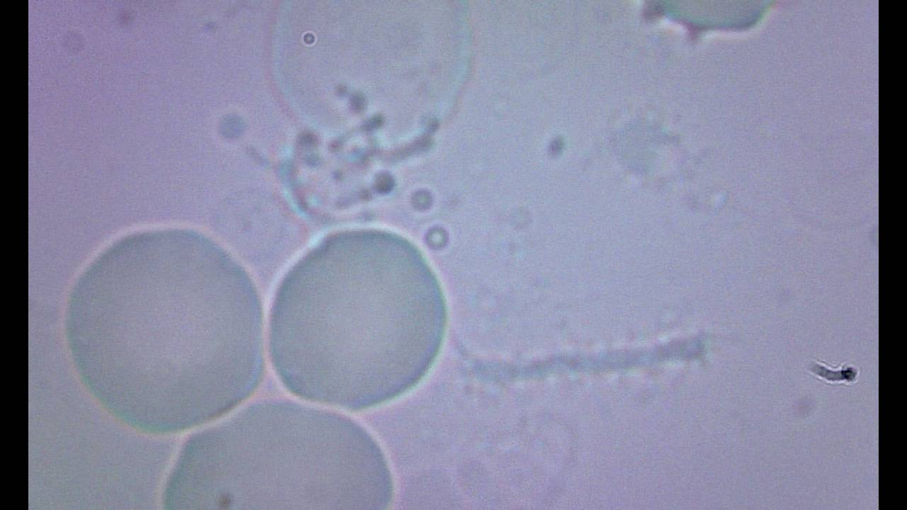 Lyme under the microscope 9 - YouTube