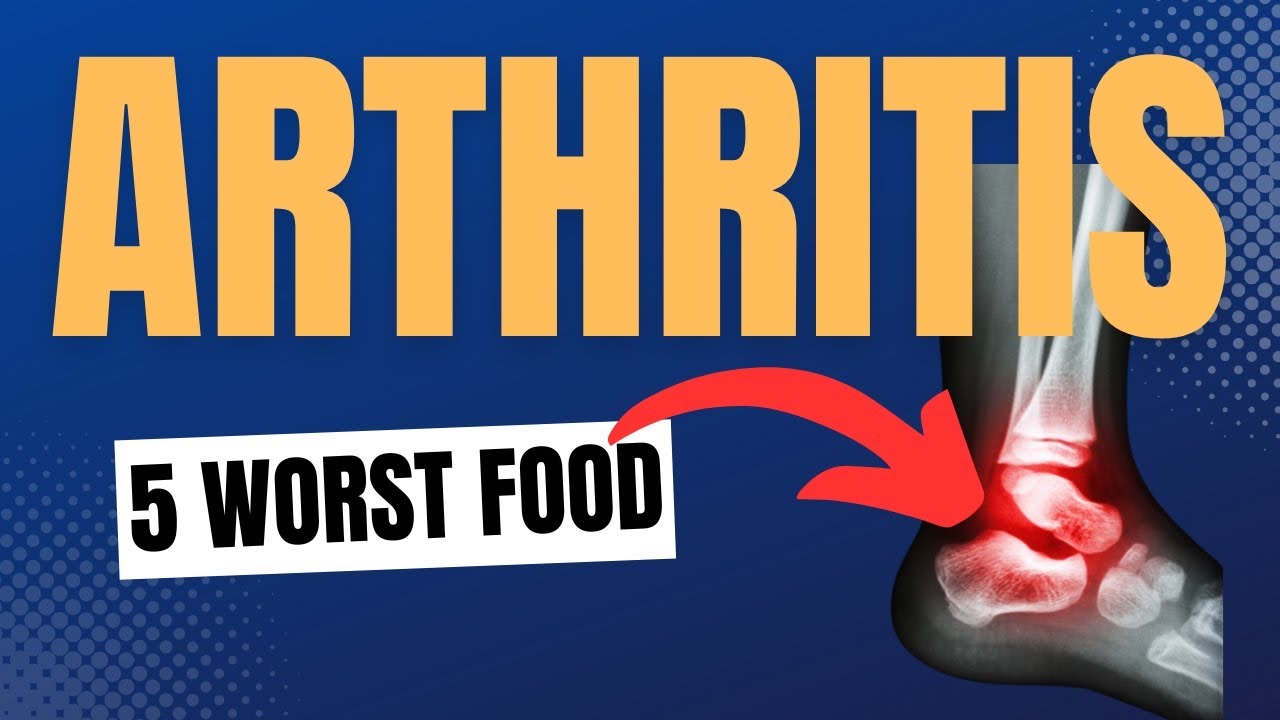 The 5 worst foods for arthritis I Nature Heal - YouTube