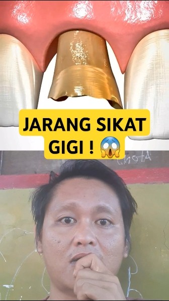 Akibat Jarang Sikat GiGi 😱🤯 #shorts #edukasi - YouTube
