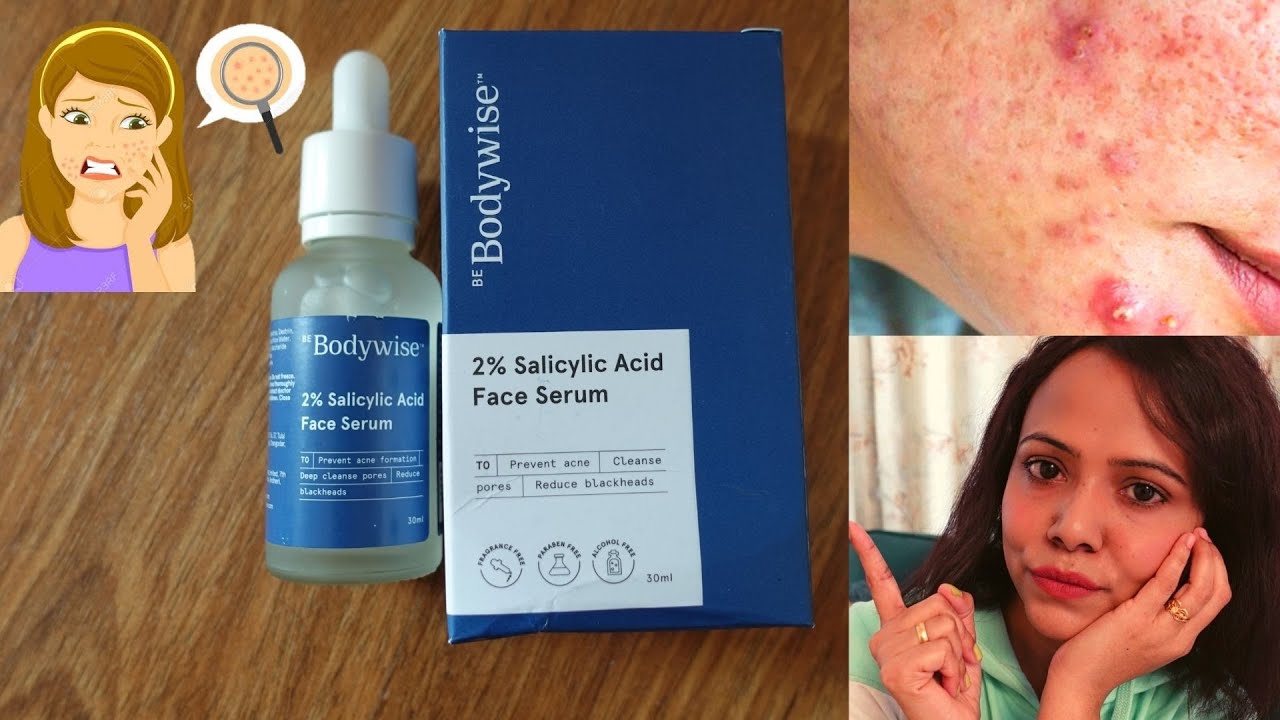 Doctor Recommended || Bodywise Salicylic Acid ||Get Rid of Acne,Whiteheads,Clogged Pores ...