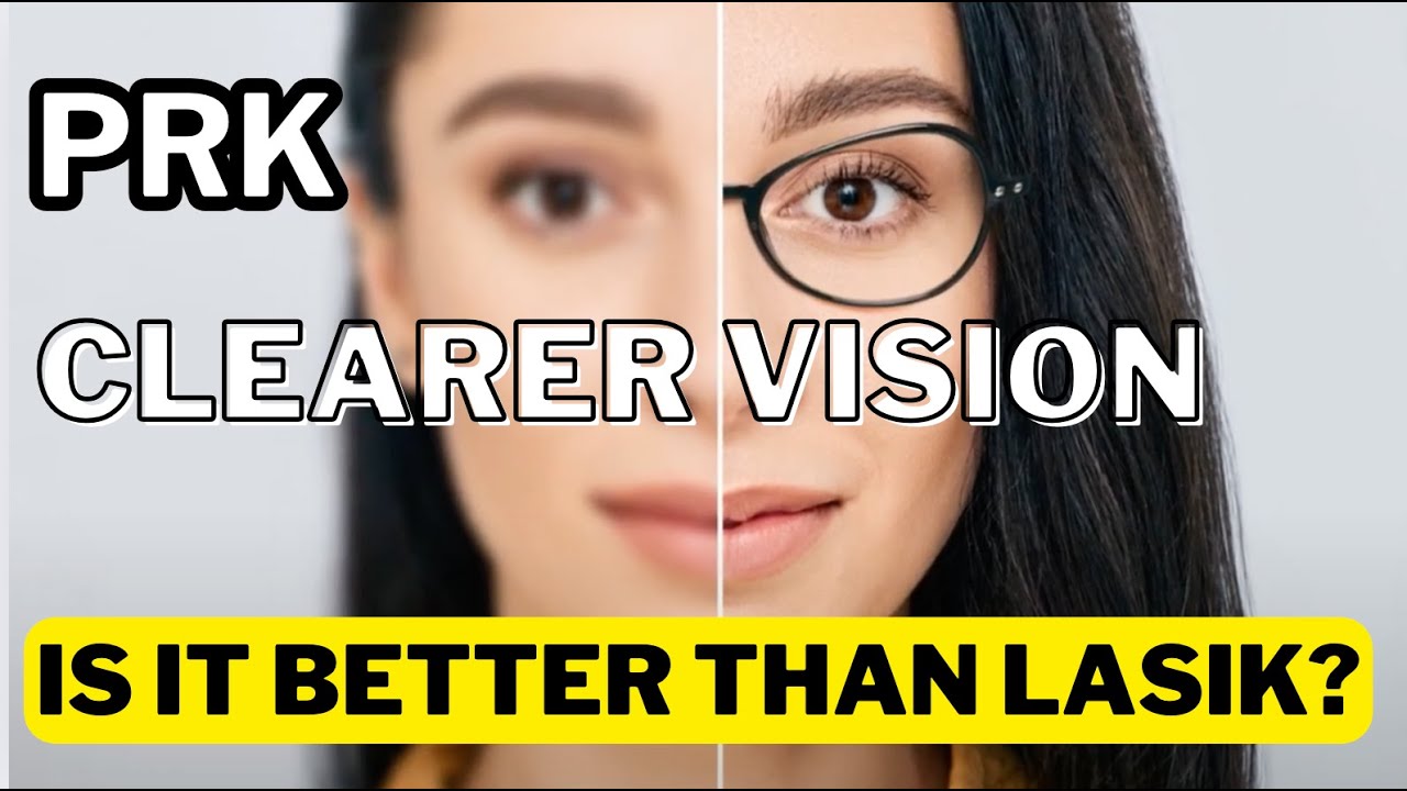 Understanding PRK Eye Surgery: Procedure, Benefits, and Recovery - YouTube