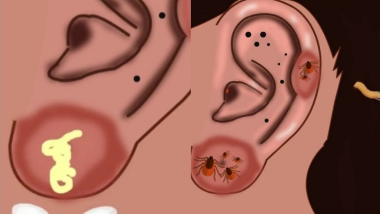 Animation of removing an earworm ASMR. Treatment and care of the farmer ...