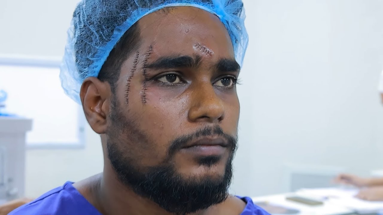 Scar Revision Surgery - Permanent Scar Removal, Scar Revision Surgery ...