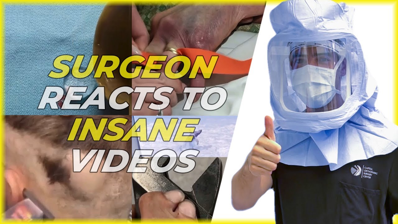 Surgeon Reacts to Crazy Medical Videos - YouTube