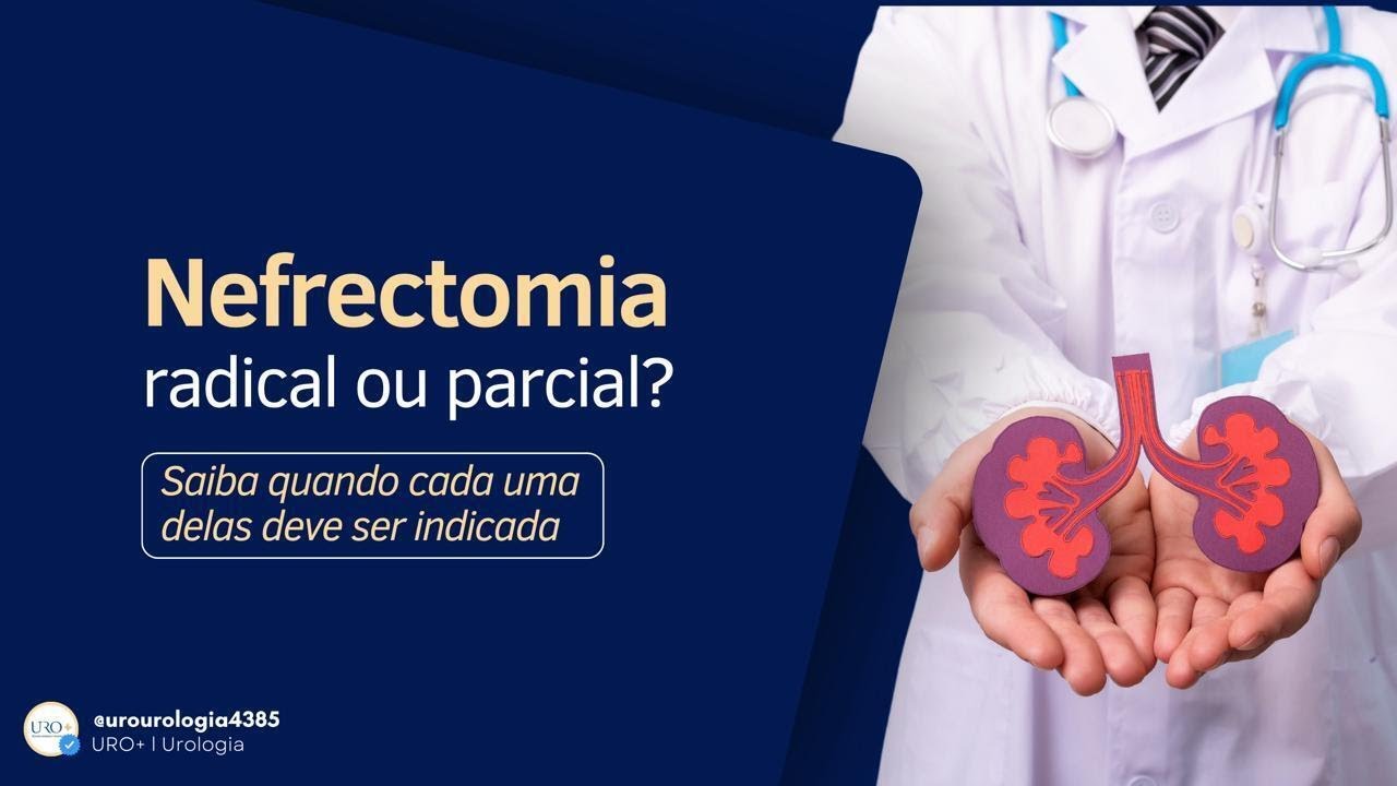 Nefrectomia radical ou parcial? Saiba quando cada uma delas deve ser ...