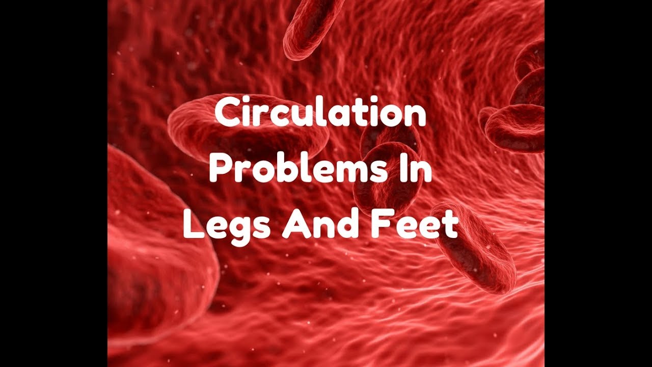 circulation problems in legs and feet - YouTube