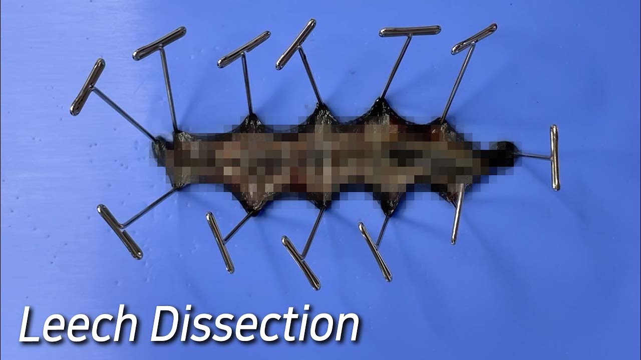 Strange Organ Inside a Leech ! - Leech Dissection - YouTube